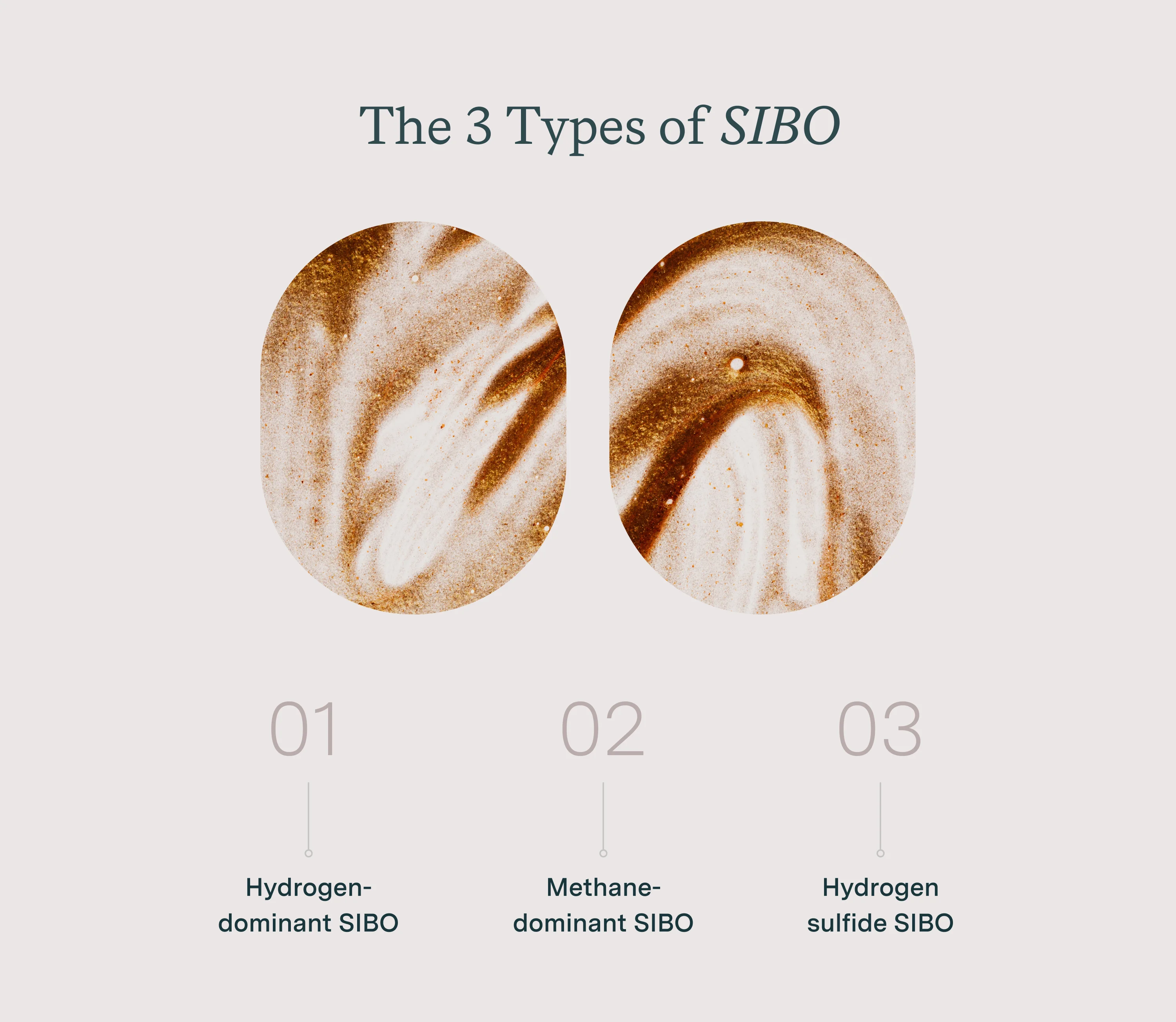 The 3 Types Of SIBO (And How They're Treated)